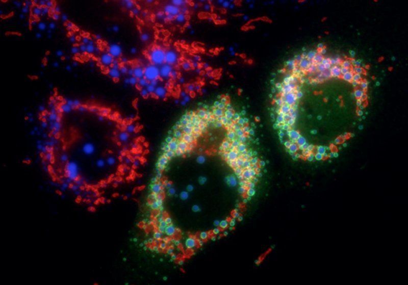 Lipid Droplets Are Intracellular Bacteria-Fighting Machines | The Scientist