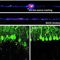 Bace1 | The Scientist