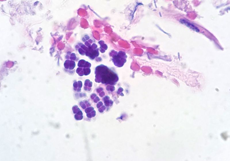 New Bacterium Linked to Chimp Deaths | The Scientist