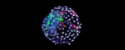 Human-Monkey Chimeras Shed Light on Development | The Scientist