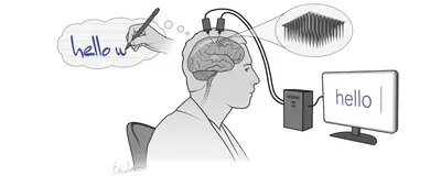Brain-Computer Interface (BCI): Revolutionizing Communication with Mind ...