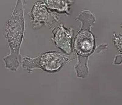 Engineered Immune Cells Eliminate Brain Cancer in Mice | The Scientist