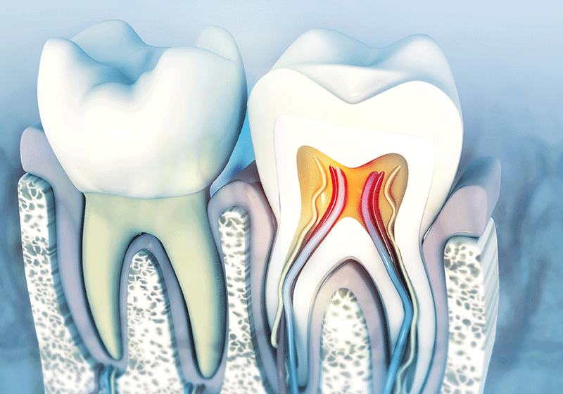 Stem Cells in Human Teeth Follow the Rules of Their Environment | The ...