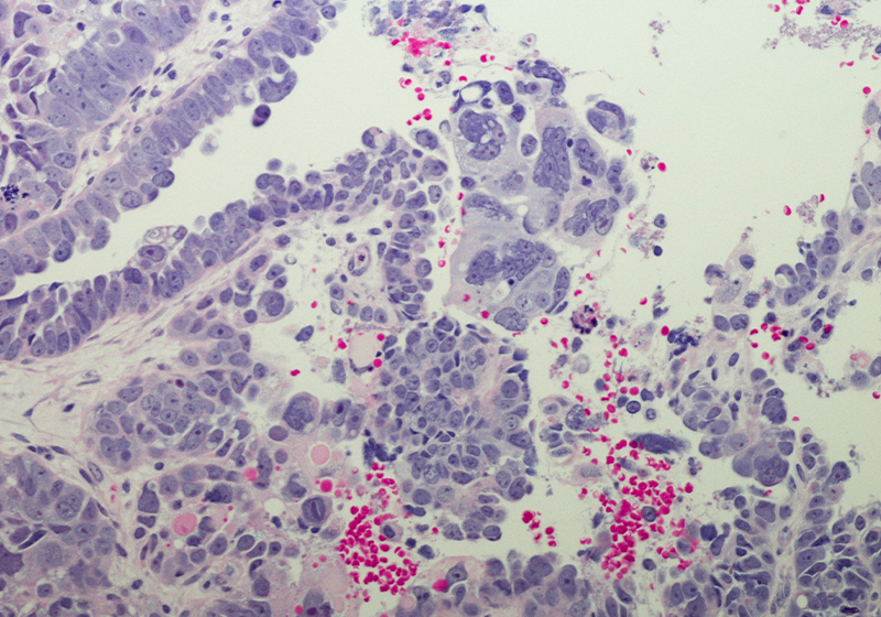 Technique Talk: The Basics of Immunohistochemistry | The Scientist