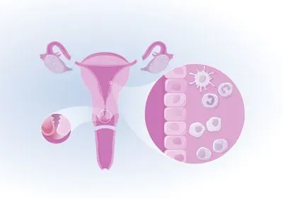 Uterus Transplant | The Scientist