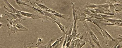 Gene Offers Clue to How Human Labor Starts | The Scientist