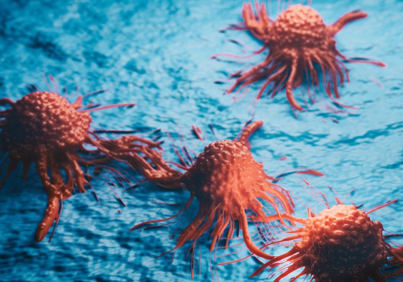 Aging and Cancer: A Complex Relationship | The Scientist