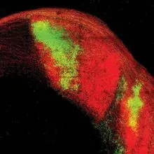 Visual Field | The Scientist