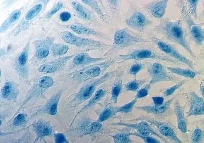 HeLa Cells | The Scientist