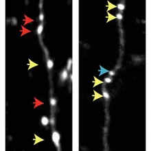 Autism Spectrum Disorder | The Scientist