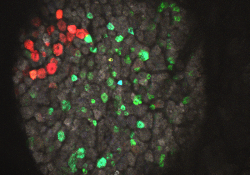 Neurons Firing Together Generate Spontaneous Pain | The Scientist