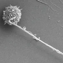 Cancer Cell Nanotubes Hijack Mitochondria from Immune Sentinels | The ...