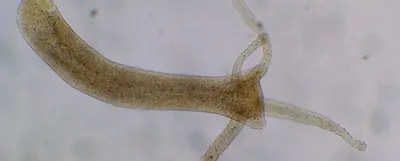 How Hydras Regenerate Decapitated Heads | The Scientist