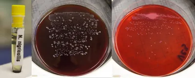 Study Questions Sterility of Snake and Spider Venoms | The Scientist