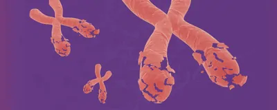 How Chaos in Chromosomes Helps Drive Cancer Spread | The Scientist