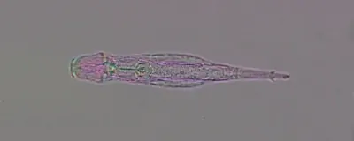 Bacterial Enzyme Keeps Rotifers’ Transposable Elements in Check | The ...
