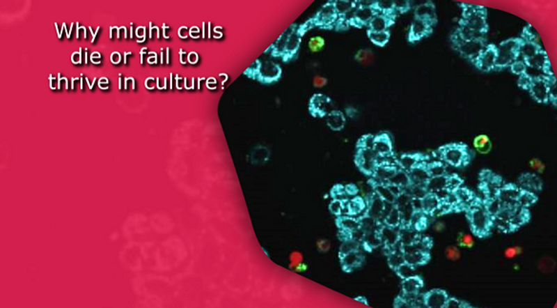 Why Might Cells Die or Fail to Thrive in Culture? | The Scientist