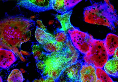 Seeing is Believing with Automated Single Cell Precision Imaging | The ...