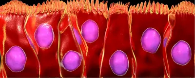 Move Over Apoptosis: Another Form of Cell Death May Occur in the Gut ...