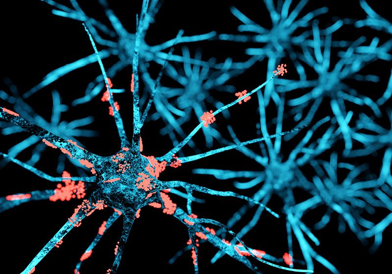 Mutant T Cells That Drive Amyotrophic Lateral Sclerosis (ALS ...