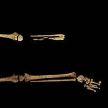 31,000-Year-Old Skeleton Reveals Oldest Known Surgery | The Scientist