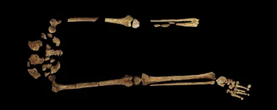 31,000-Year-Old Skeleton Reveals Oldest Known Surgery | The Scientist