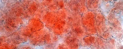 Mouse Brains Appear to Eavesdrop on Their Fat | The Scientist