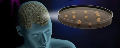 Capturing Brain Complexity in Assembloids | The Scientist