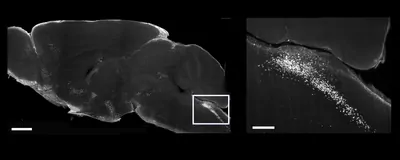 Research Pinpoints the Neurons Behind Feeling Sick | The Scientist