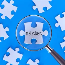 Metastasis | The Scientist