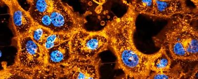 Science Snapshot: More Fun Than a Barrel of Monkey Cells | The Scientist