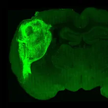 Researchers Transplant Human Neurons into Rat Brains | The Scientist