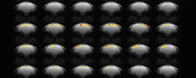 New MRI Technique Tracks Brain Activity at Millisecond Timescales | The ...