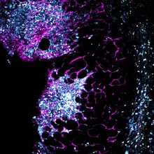 How Fat Cells Help Kick Parasites Out of Mice: Study | The Scientist