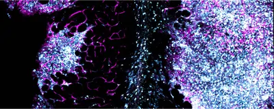 How Fat Cells Help Kick Parasites Out of Mice: Study | The Scientist