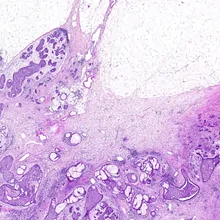 Soft Tissue | The Scientist