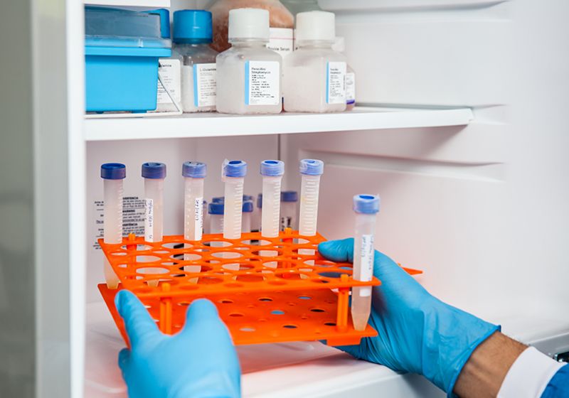 Protecting Precious Samples with the Right Storage Conditions | The ...