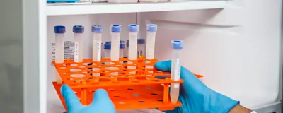 Protecting Precious Samples with the Right Storage Conditions | The ...