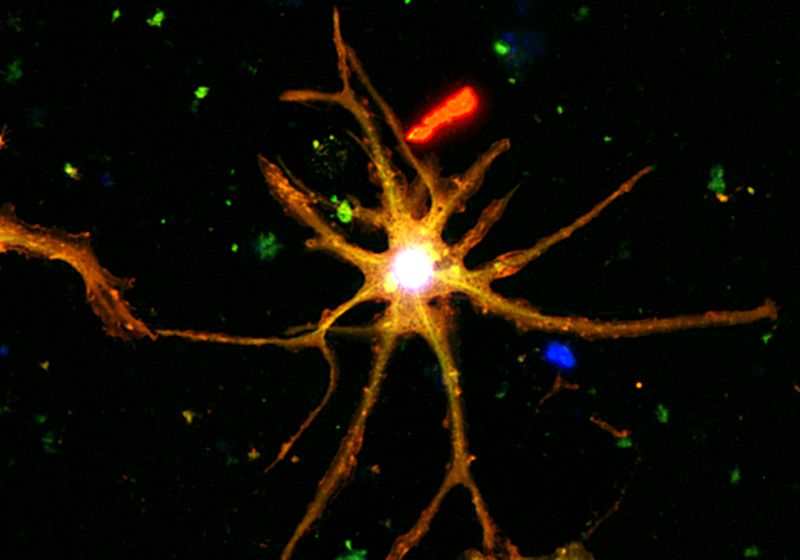 Immune Cells Imitating Neurons Cause Pain in Mice with Tumors | The ...