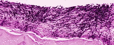 Fungal Pathogens Flourish in the Pandemic’s Shadow | The Scientist