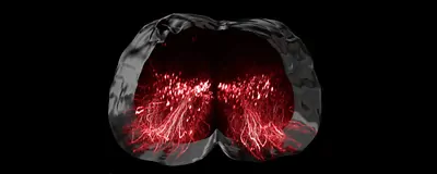 Scientists Identify Neurons Needed to Walk After Paralysis | The Scientist