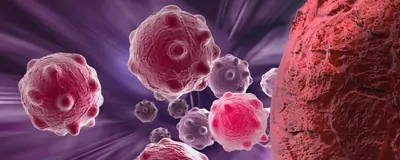 Cancer Cells Gather Speed in Thicker Fluids | The Scientist