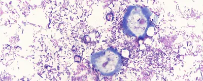 Recently Discovered Virus Family Infects a Human Oral Amoeba | The ...