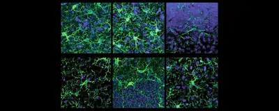 Mapping Tool Reveals Microglia’s Shape-Shifting Secrets | The Scientist