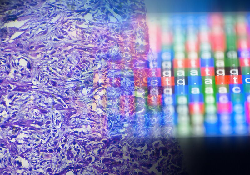 The Genetics of Cancer Risk | The Scientist