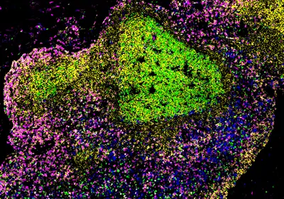 Lymph Nodes | The Scientist