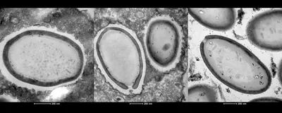 Giant Viruses Grew Out of Small Ones: Study | The Scientist