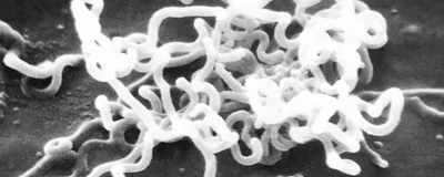 Science Falls Behind as Syphilis Stages Another Comeback | The Scientist