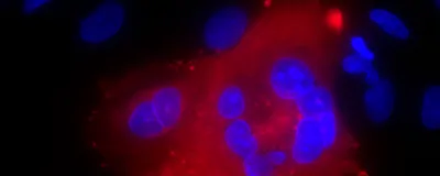 How Genes from Neanderthals Predispose People to Severe COVID-19 | The ...