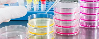 Capturing Exosomes from Cell Culture Media | The Scientist